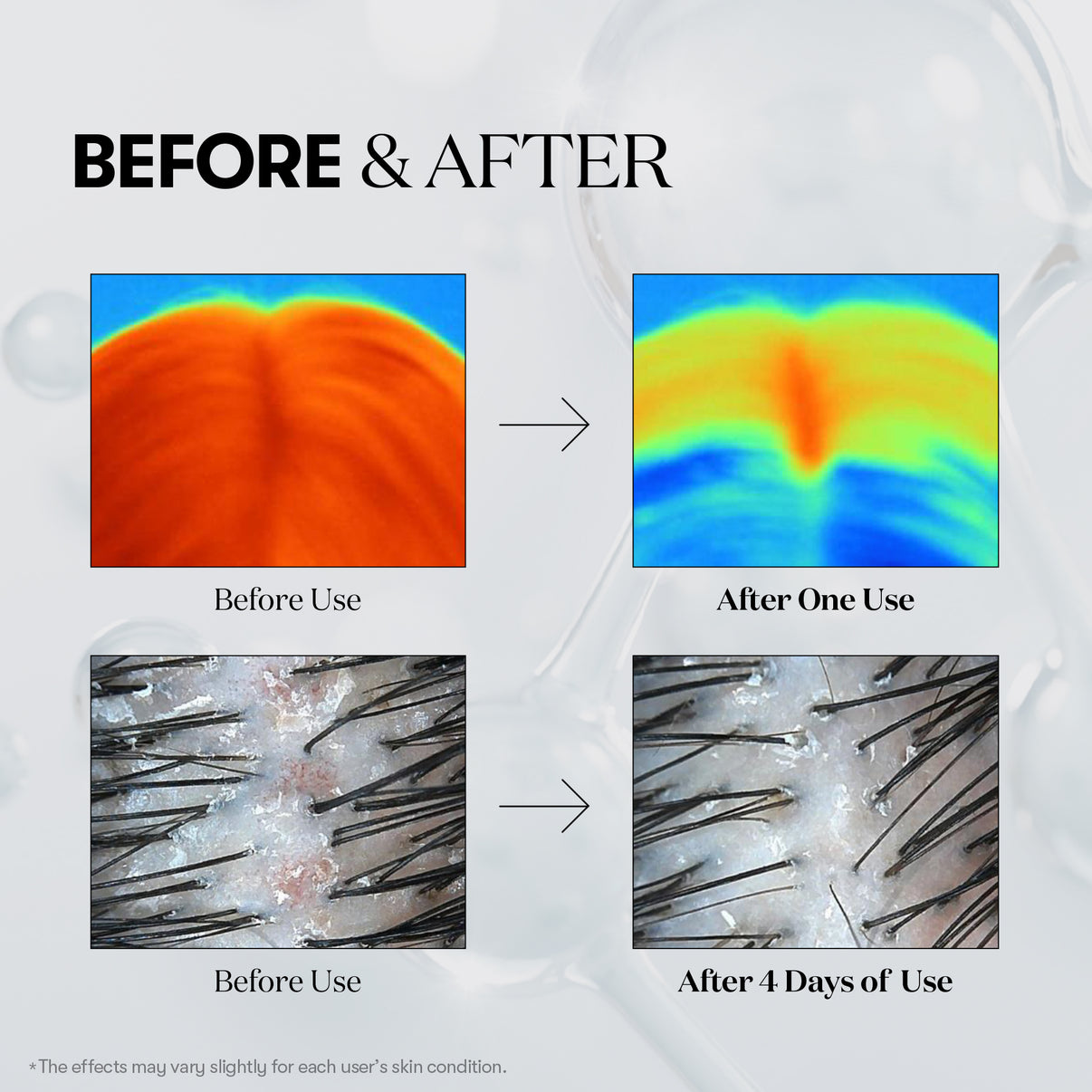 PDRN Reedle Shot Hair Ampoule 100dl – VT Cosmetics official